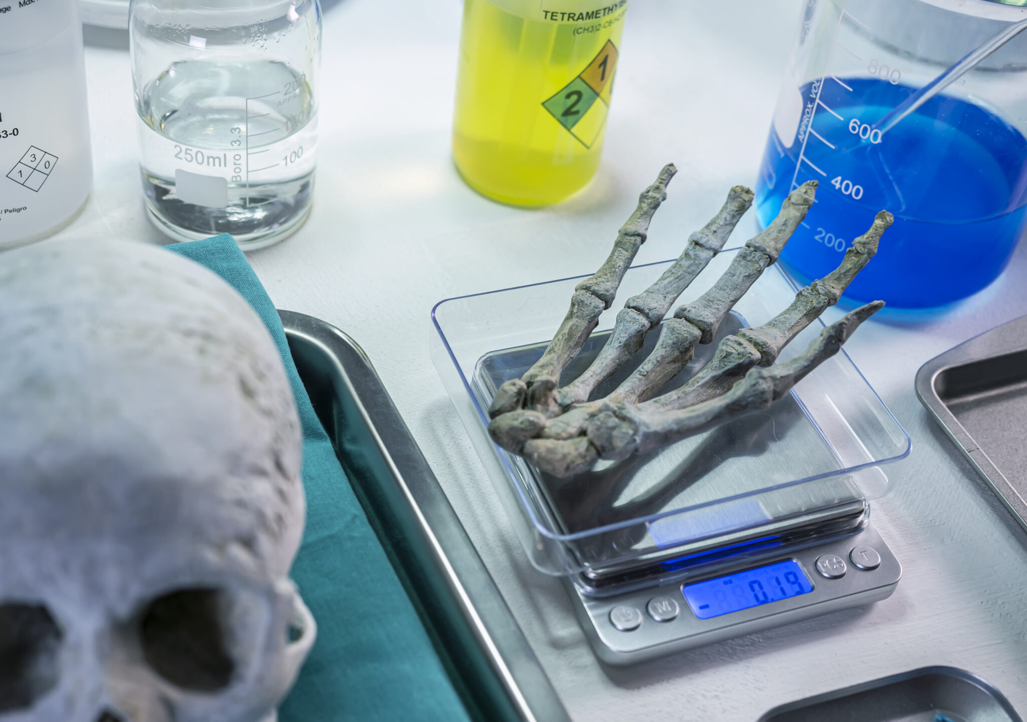 How Long Does Embalming Last? (Must Know Guide)